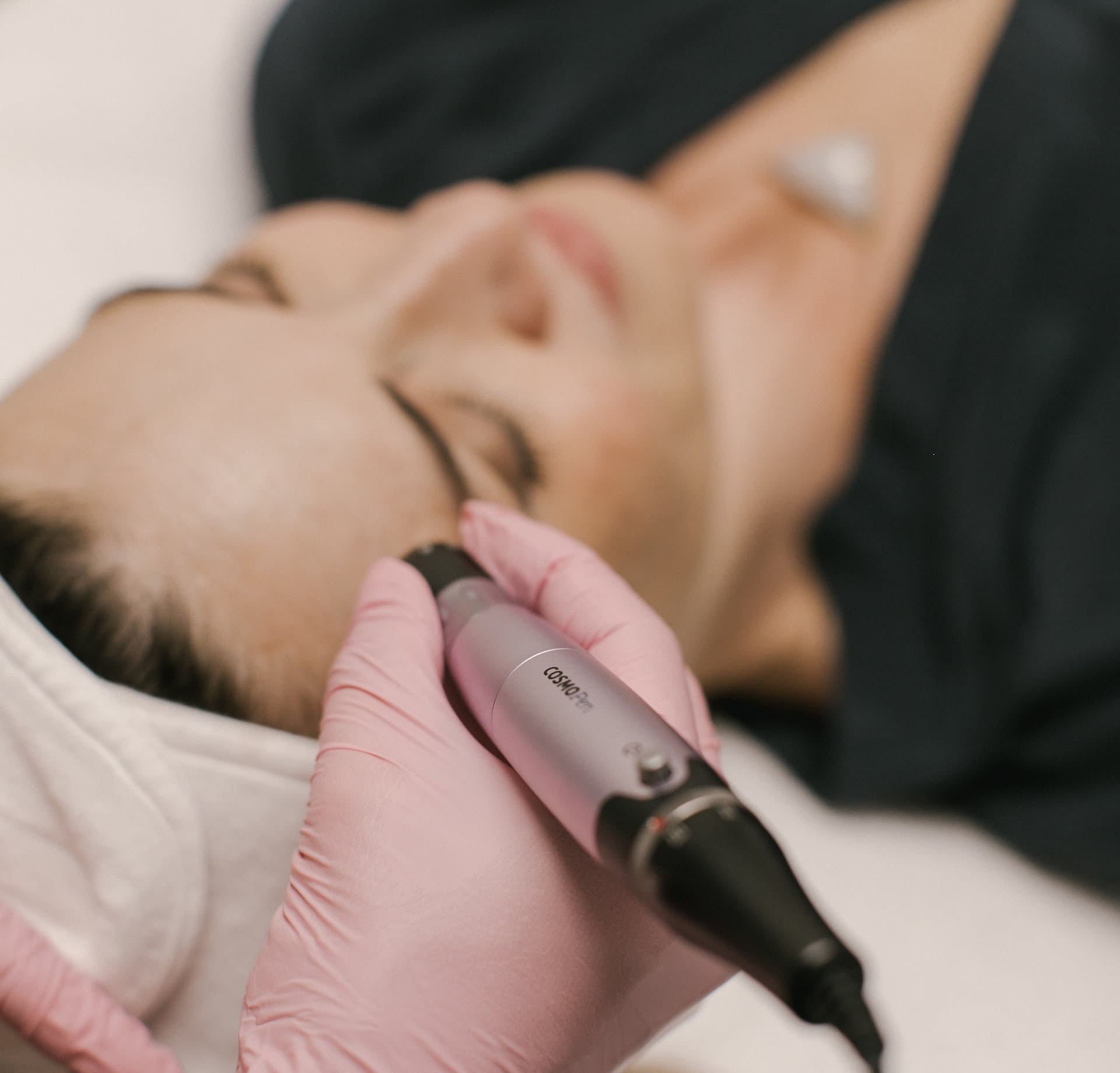 Treat large pores with Microneedling! - Skin Method